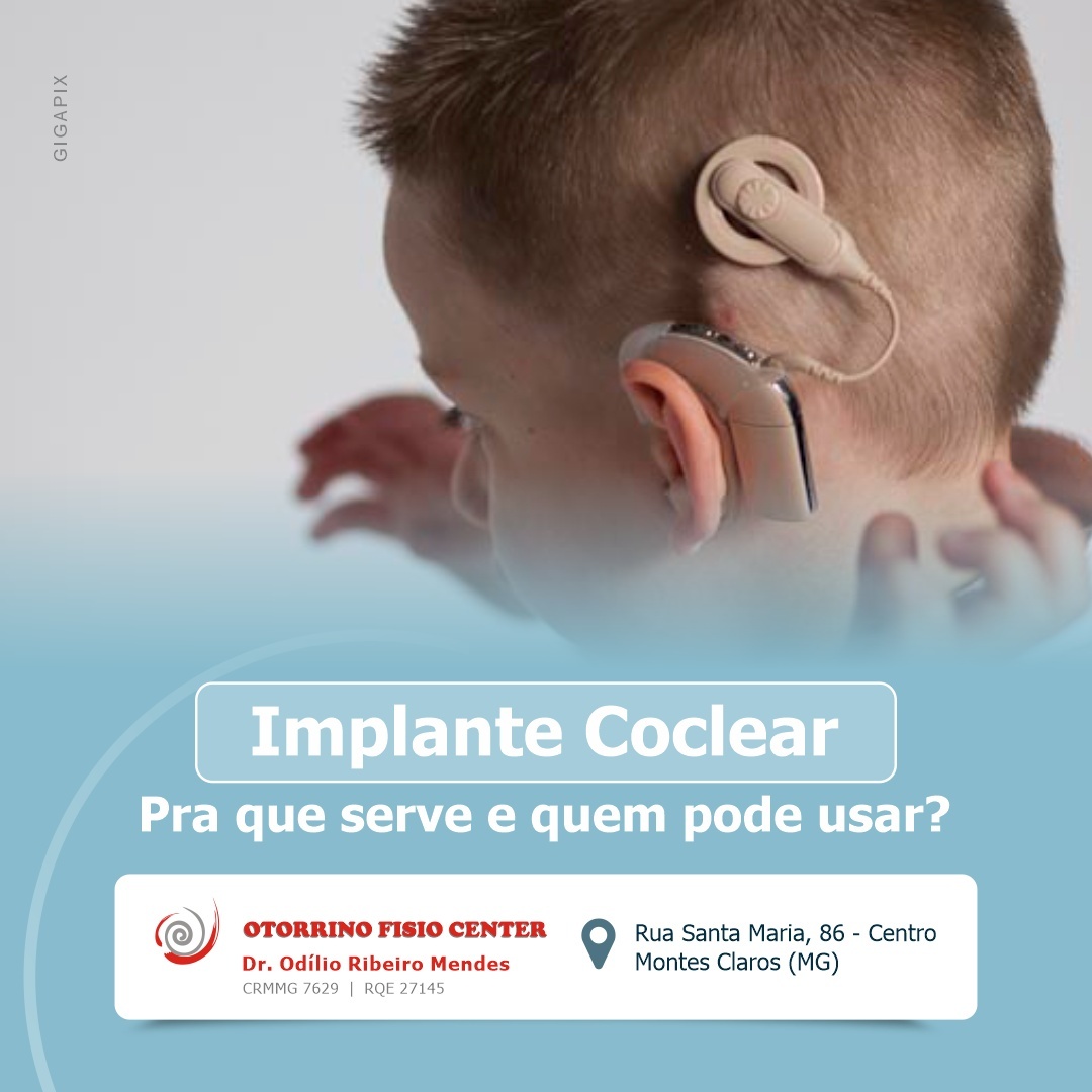 Implante Coclear - Otorrino Fisio Center